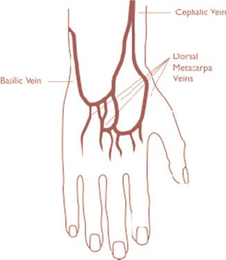 Getting Off: The Basics of Safer Injection - National Harm Reduction ...